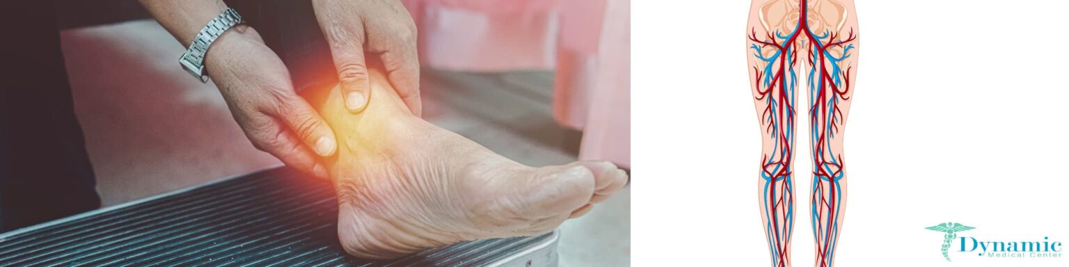 How to Spot the Signs of Neuropathy? – Dynamic Medical Center